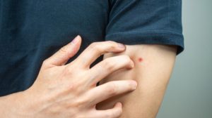 How To Get Rid Of Palmetto Bugs | 24H Pest Pros